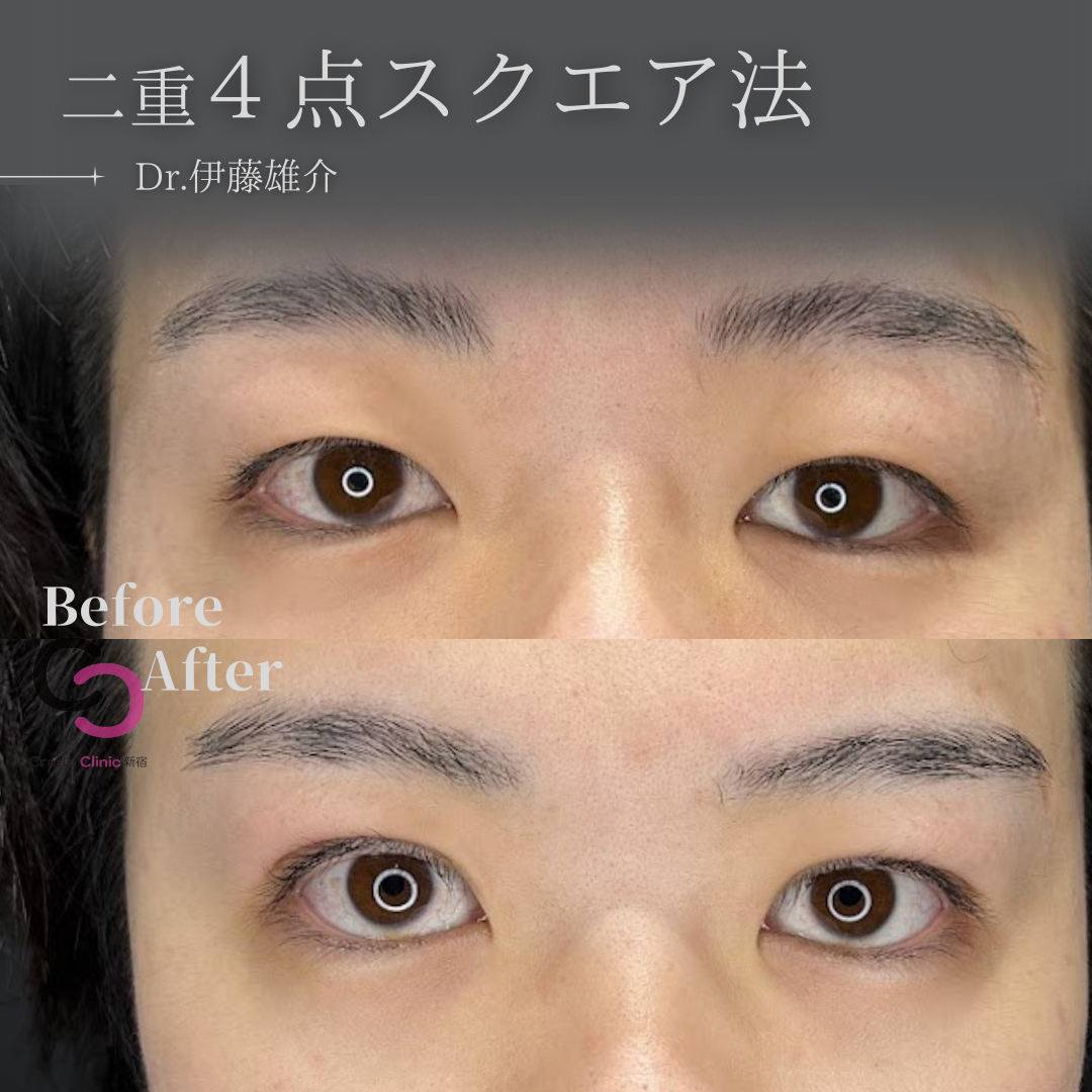 Credo Clinic | 新宿三丁目駅から徒歩0分の美容外科・美容皮膚科
