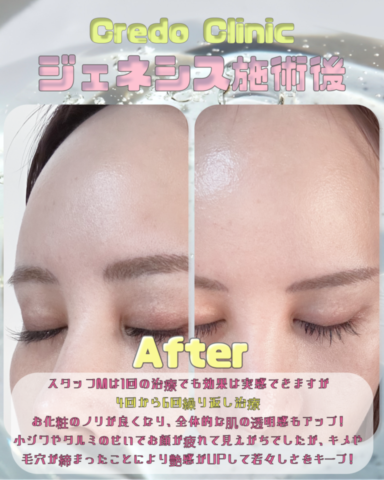 ⚡️冀ジェネシス徹底解説 﫧 – Credo Clinic